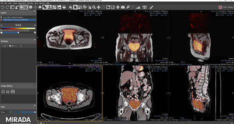 MiradaXD | Mirada Medical